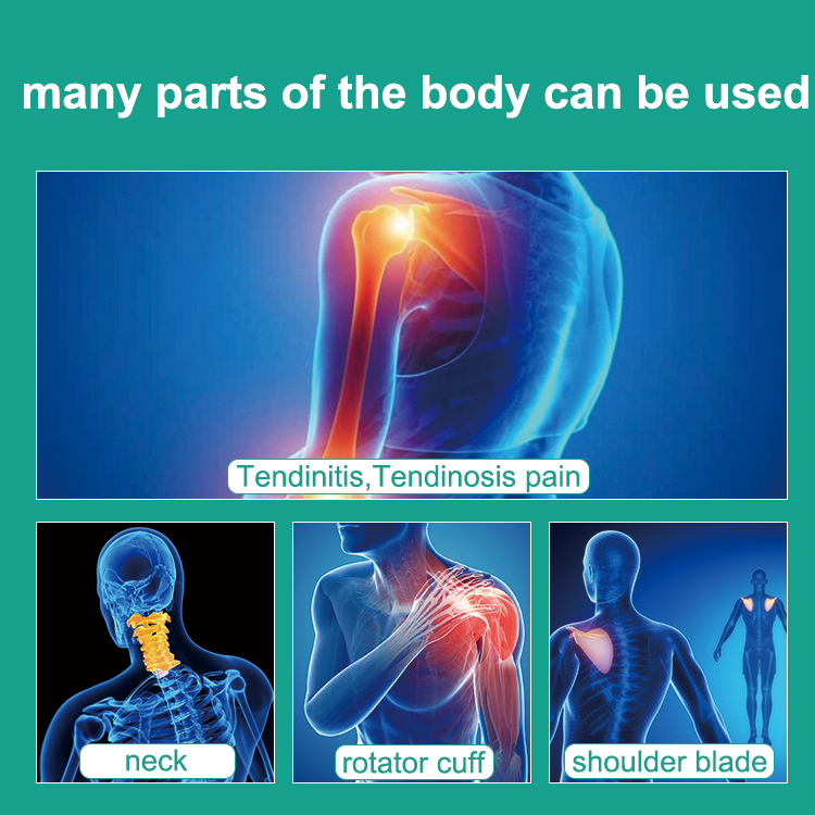 Shoulder Pain Relief Patch Methyl Salicylate - Biours Biosciences Co., Ltd.